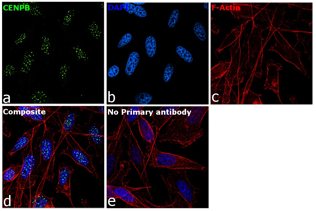 CENPB Antibody (PA5-65869)