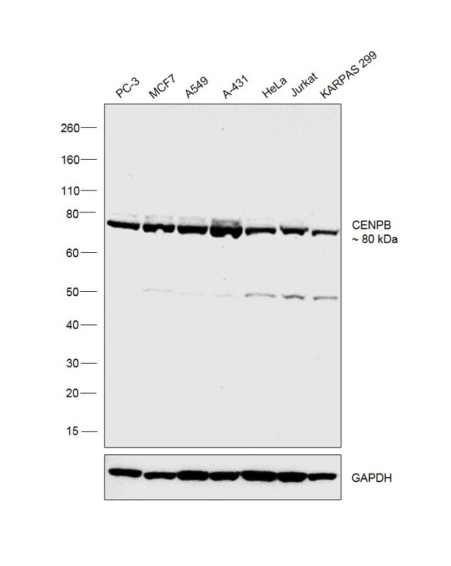 CENPB Antibody (PA5-65869)