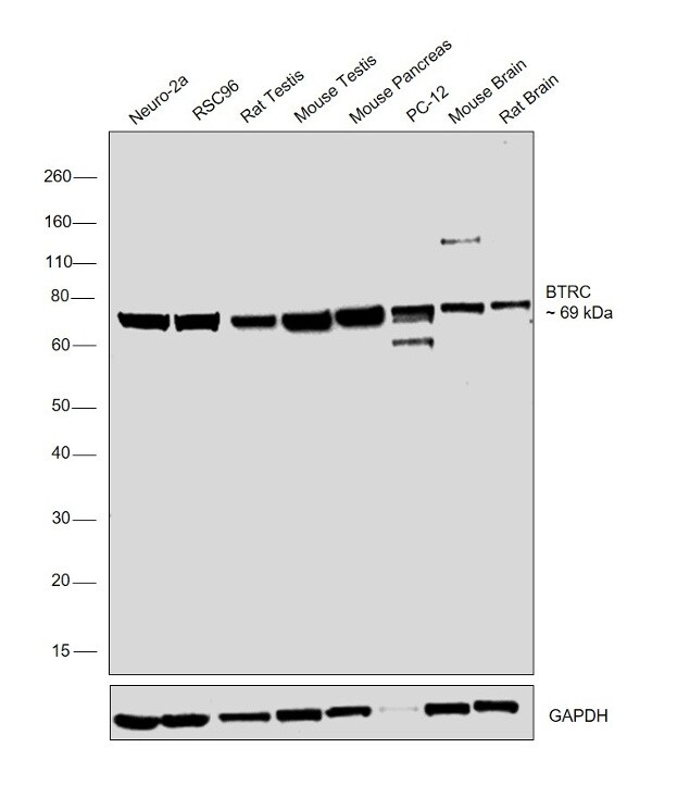 BTRC Antibody (PA5-69160)