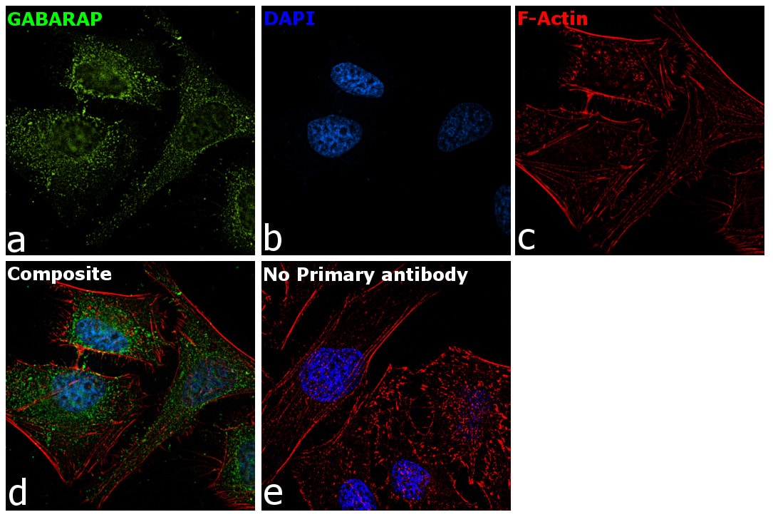 GABARAP Antibody (PA5-78366)
