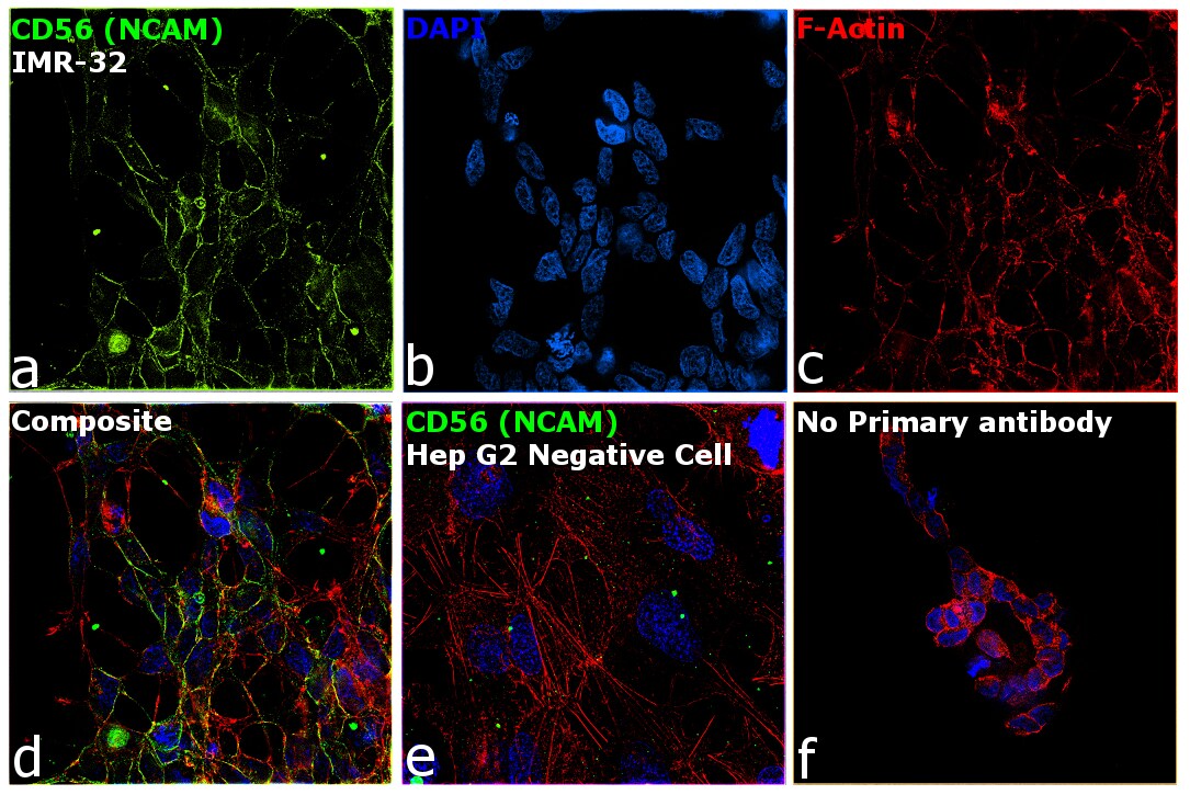 CD56 (NCAM) Antibody (PA5-78402)