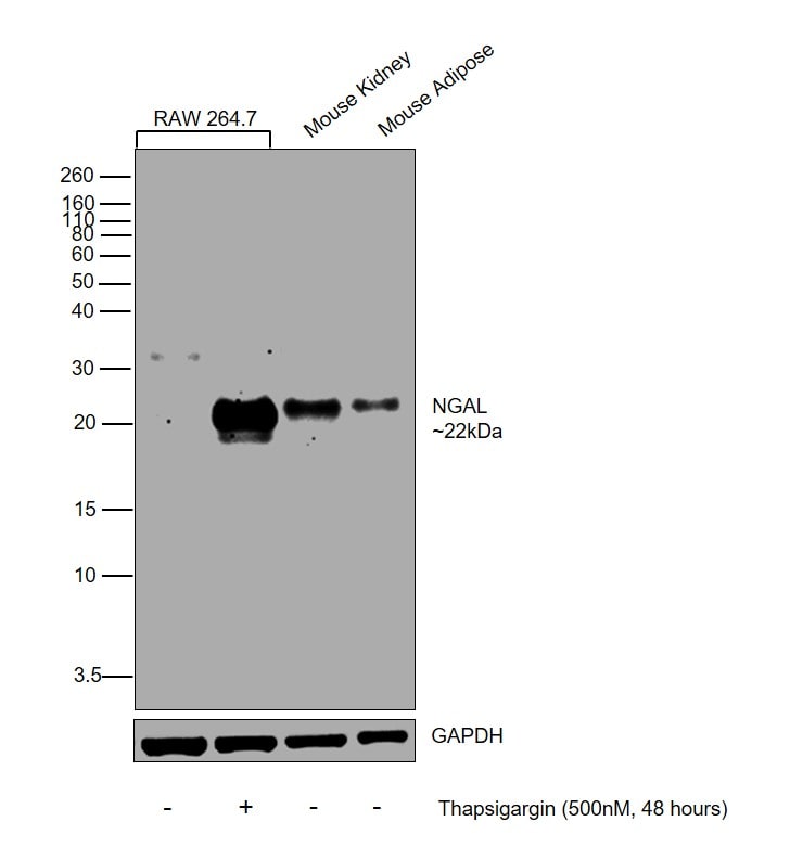 NGAL Antibody (PA5-79590)