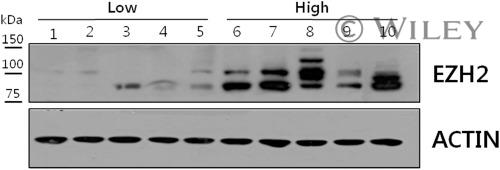 EZH2 Antibody (36-6300)