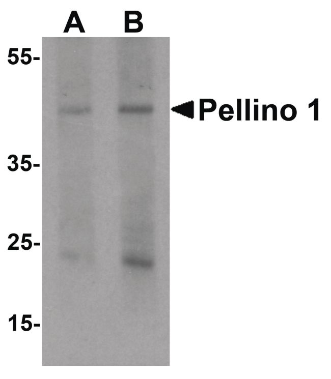 Pellino 1 Antibody (PA5-34465) Pellino 1 Antibody (PA5-34465)
