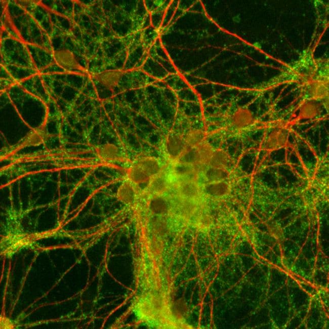 Synaptophysin Antibody (PA1-1043)