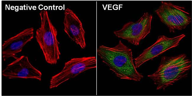 Anti-VEGF Antibodies | Invitrogen