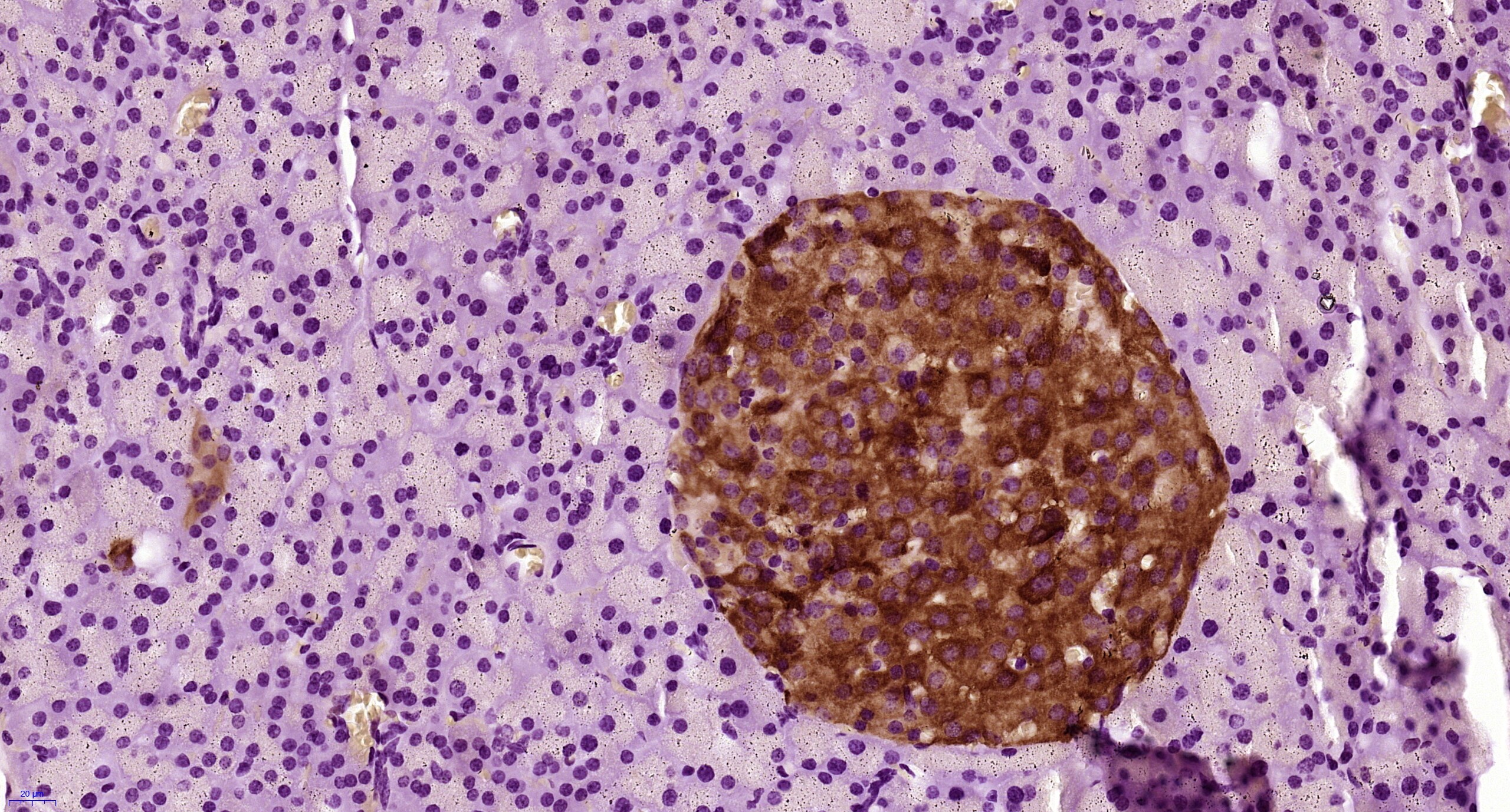 PRLR Antibody (BS-6445R)