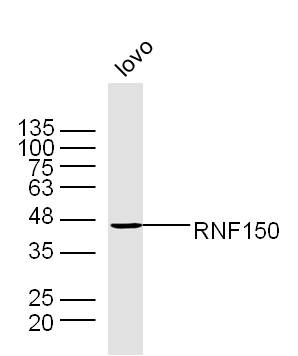 RNF150 Antibody (BS-9257R)