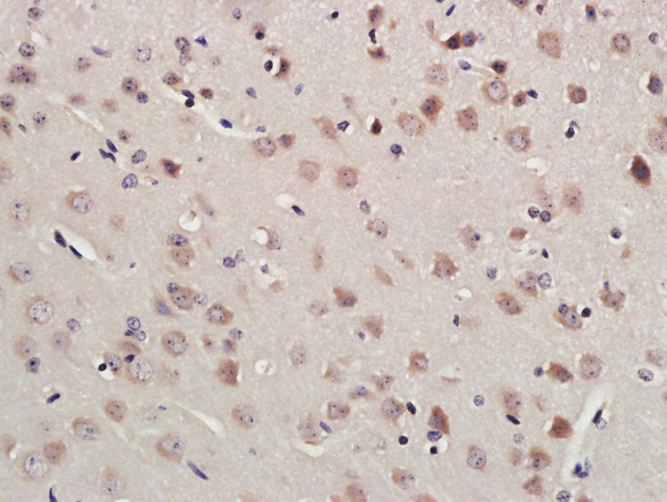 RNF213 Antibody (BS-9840R)