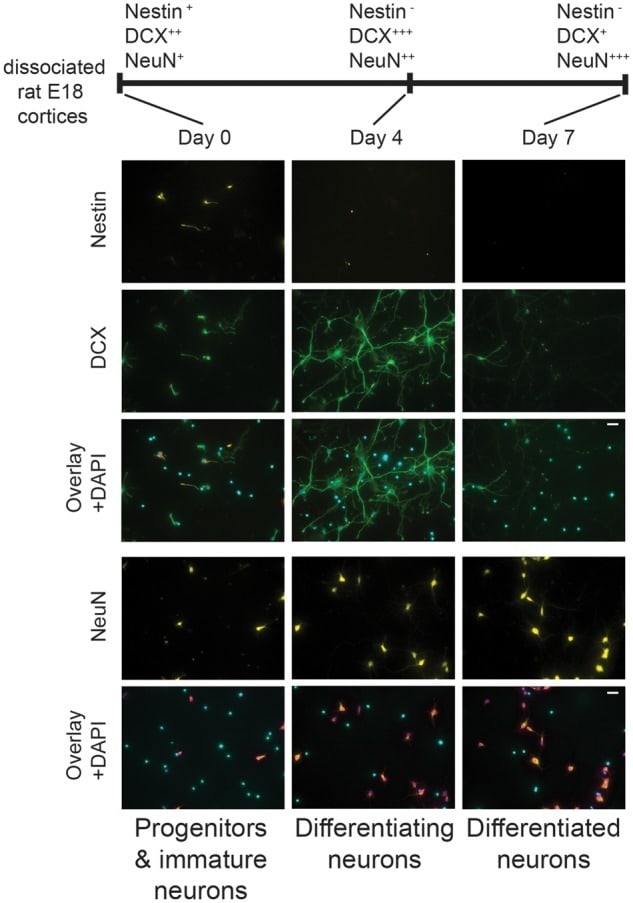 Nestin Antibody (MA1-91657)