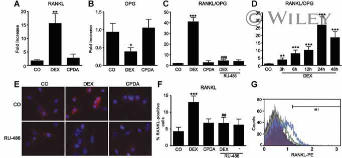 CD254 (RANK Ligand) Antibody, Biotin (13-5952-82)