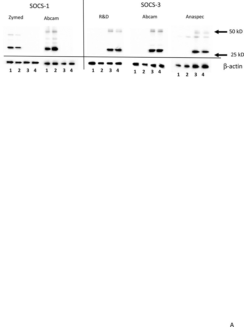 Phospho-Tau (Ser202, Thr205) Antibody (Monoclonal, AT8)