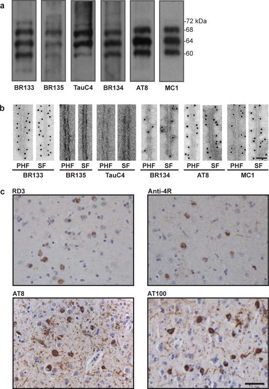 Phospho-Tau (Ser202, Thr205) Antibody (MN1020)