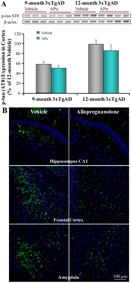 Phospho-Tau (Ser202, Thr205) Antibody (Monoclonal, AT8)