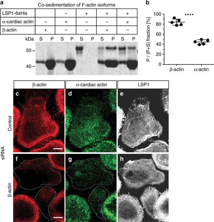 alpha-Cardiac Actin Antibody (PA5-21396)