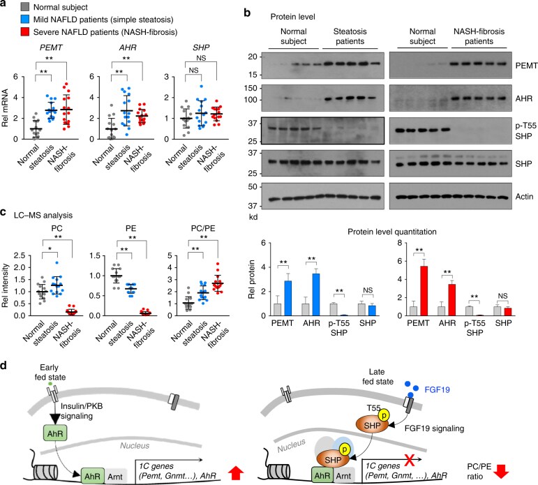 PEMT Antibody (PA5-42383)