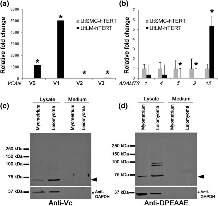 Versican V0, V1 Neo Antibody (PA1-1748A)