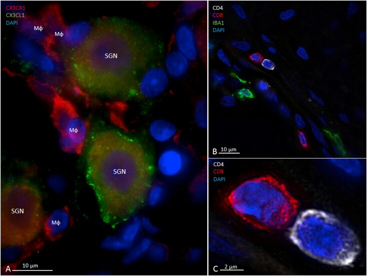 IBA1 Antibody (PA5-27436)