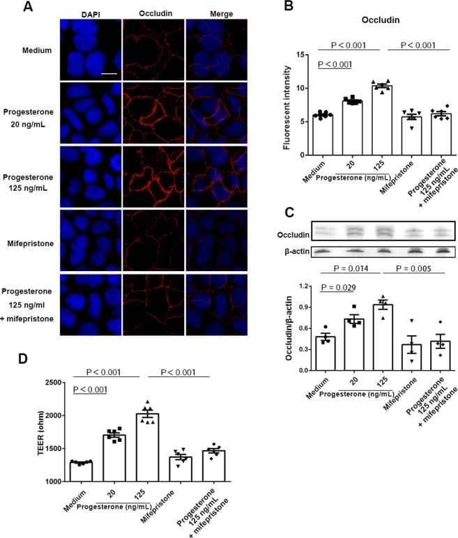 Occludin Antibody (40-4700)