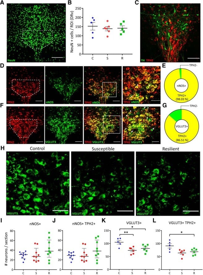 TPH2 Antibody (PA1-778)